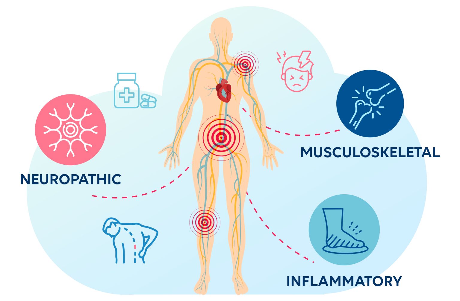 Managing Chronic Pain Without Opioids | Guide